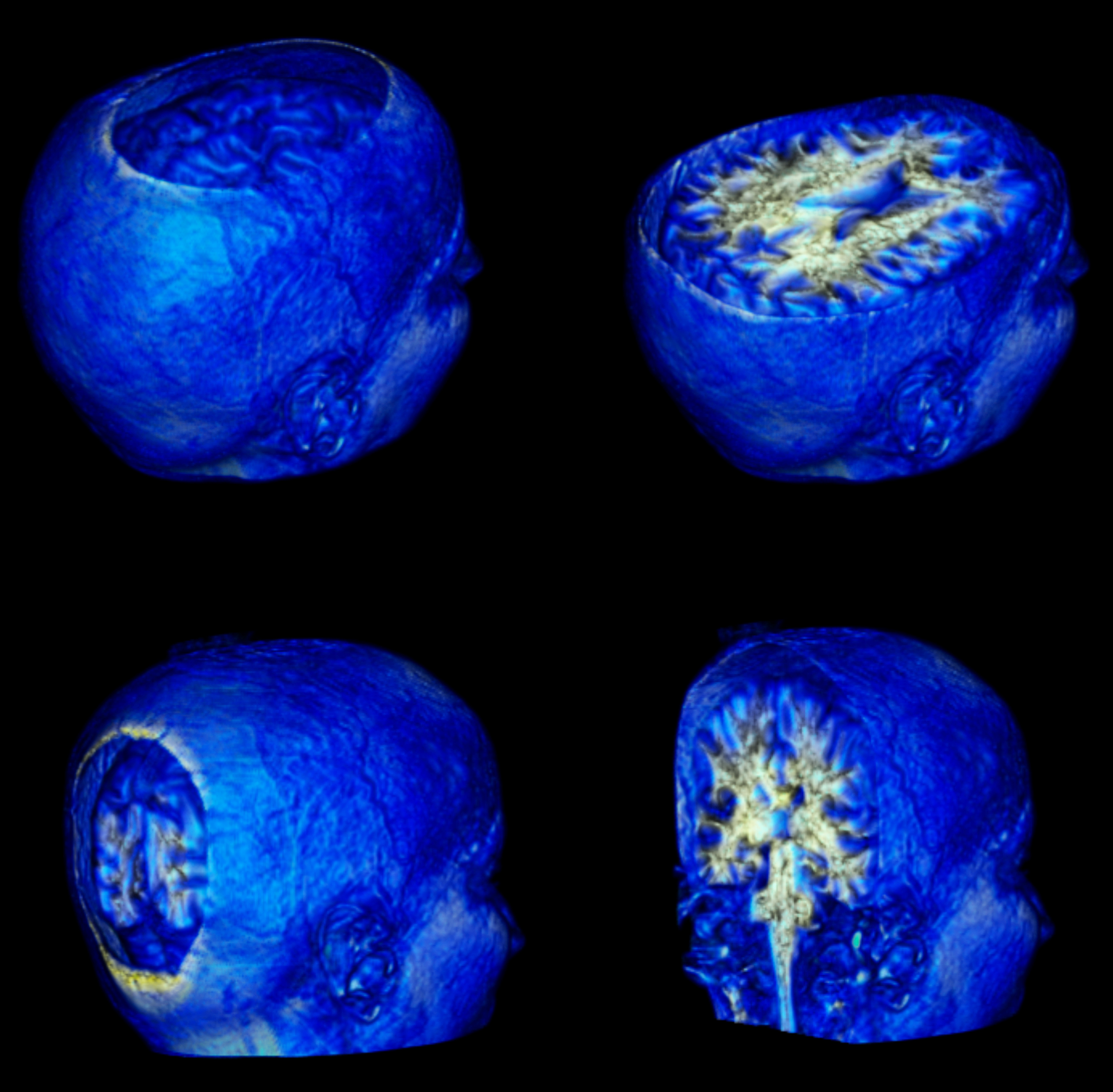 CCBBI Student Neuroimaging Research Award | Center for Cognitive and ...