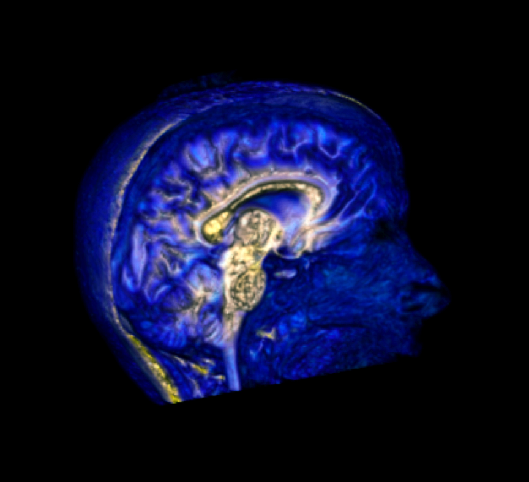 CCBBI Research Day | Center for Cognitive and Behavioral Brain Imaging